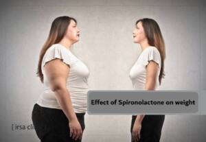 Spironolactone: Effects and Side Effects - Irsa Dermatology Clinic